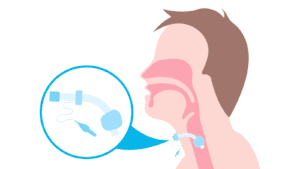 How to Care for a Patient with a Tracheostomy | HFH Healthcare